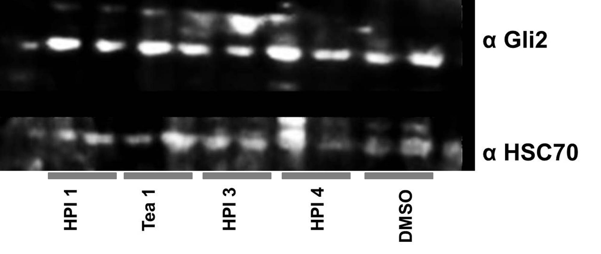 Assessment of Hedgehog/GLI2 signaling inhibitors within metastatic ...