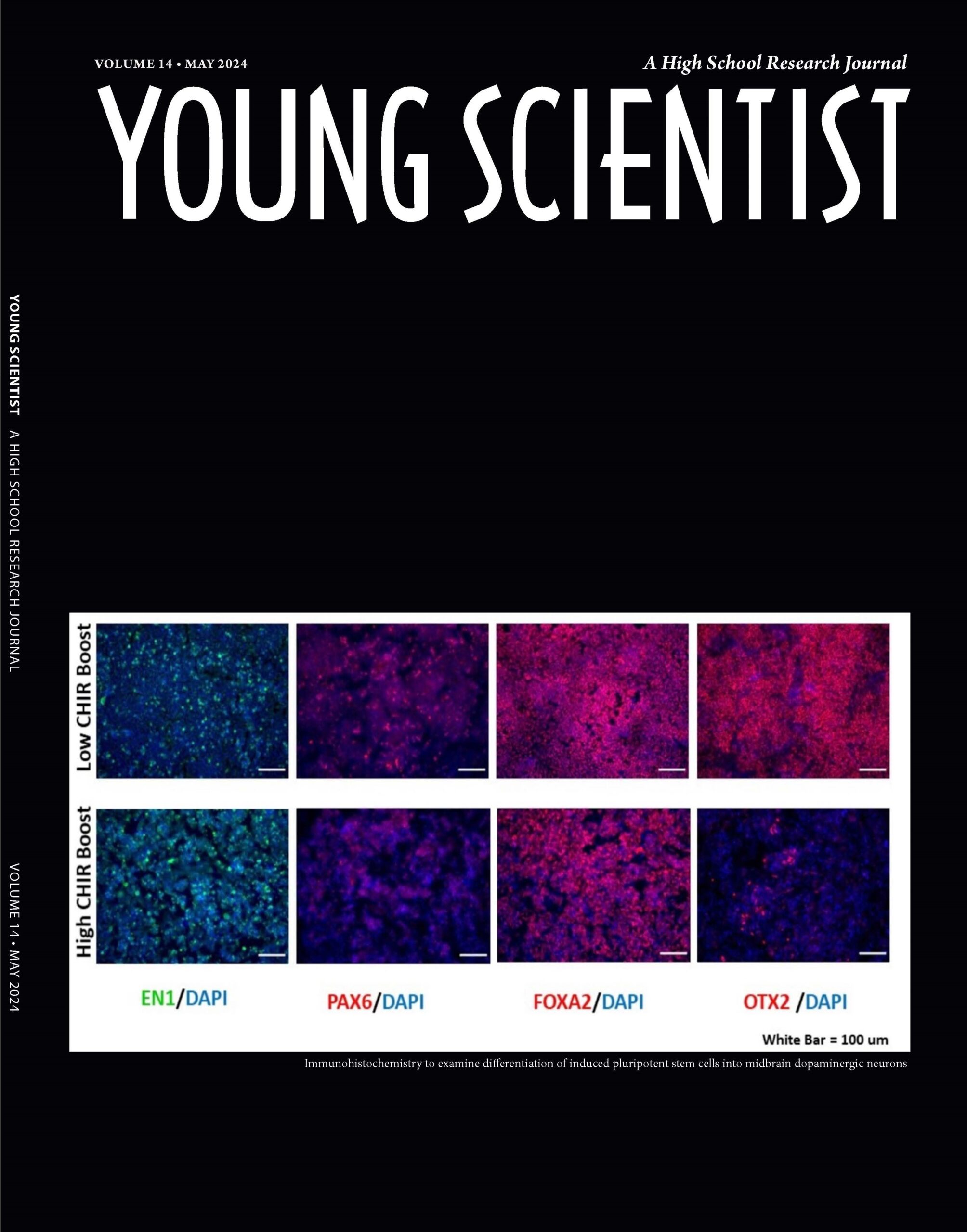 Young Scientist Journal | Vanderbilt University
